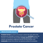 Prostate Cancer Diagnosis - Prostate Cancer Support Group Waterloo-Wellington